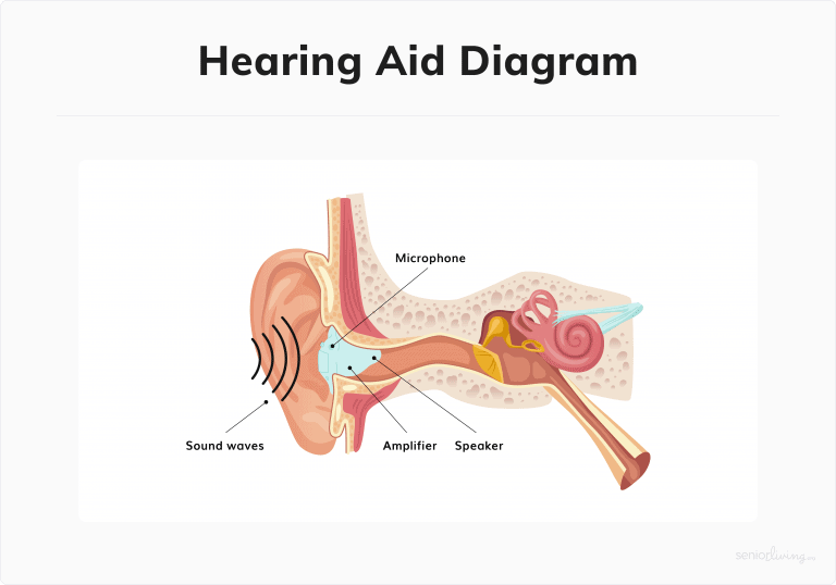 Best Hearing Aids of 2025